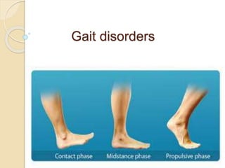 Gait Abnormalities