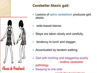 Tandem Gait Test
