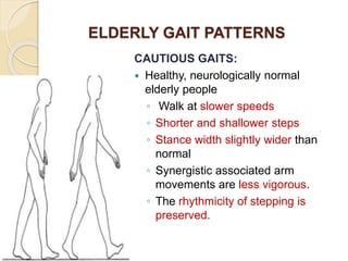 Geriatric Gait