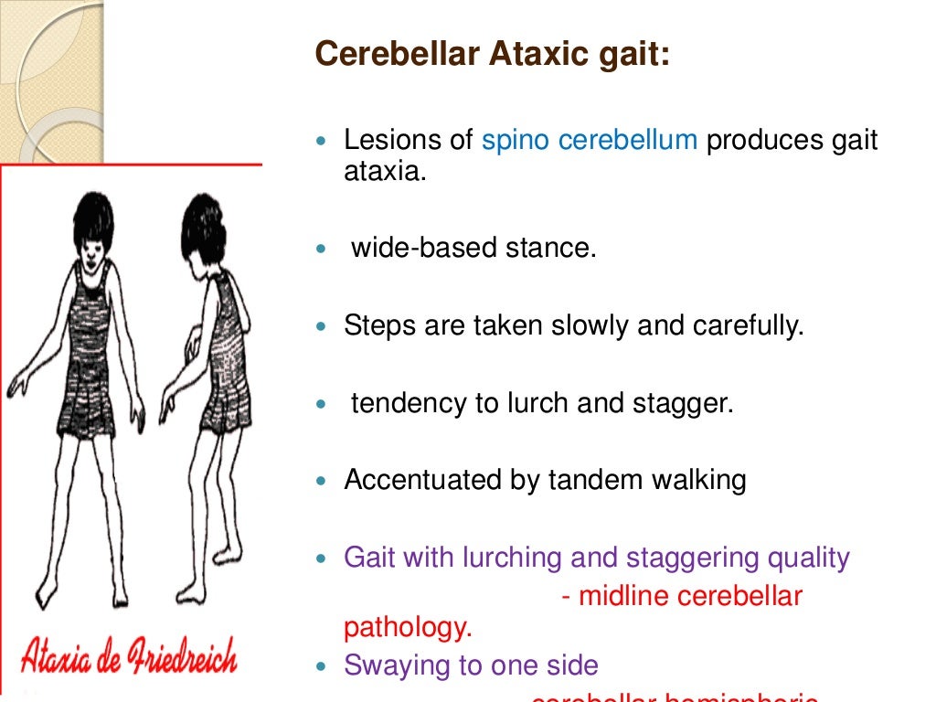 Gait disorders