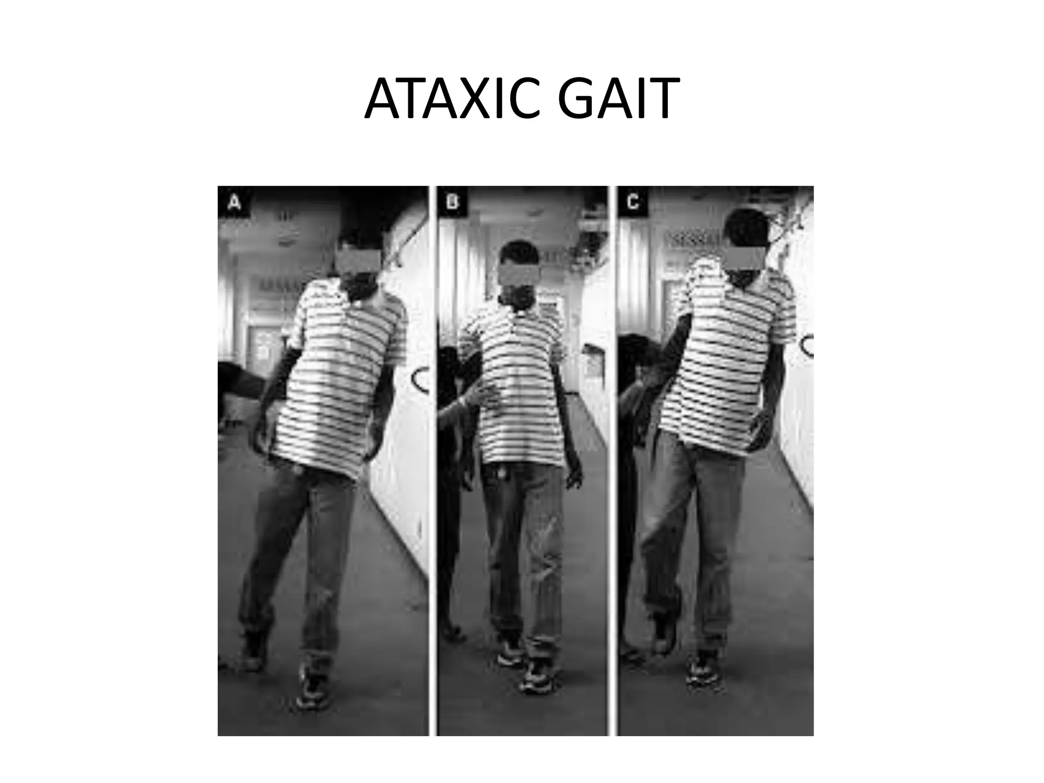 Gait disorders.pptx