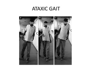 Gait disorders.pptx | Death, Injury, or Military Conflict | Sensitive Topics