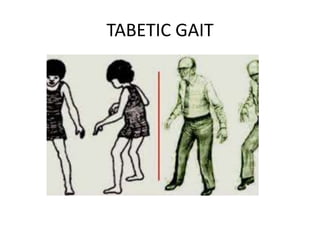 Gait disorders.pptx