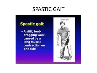 Gait disorders.pptx