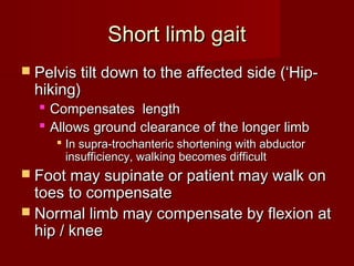 Gait for dnb | PPT