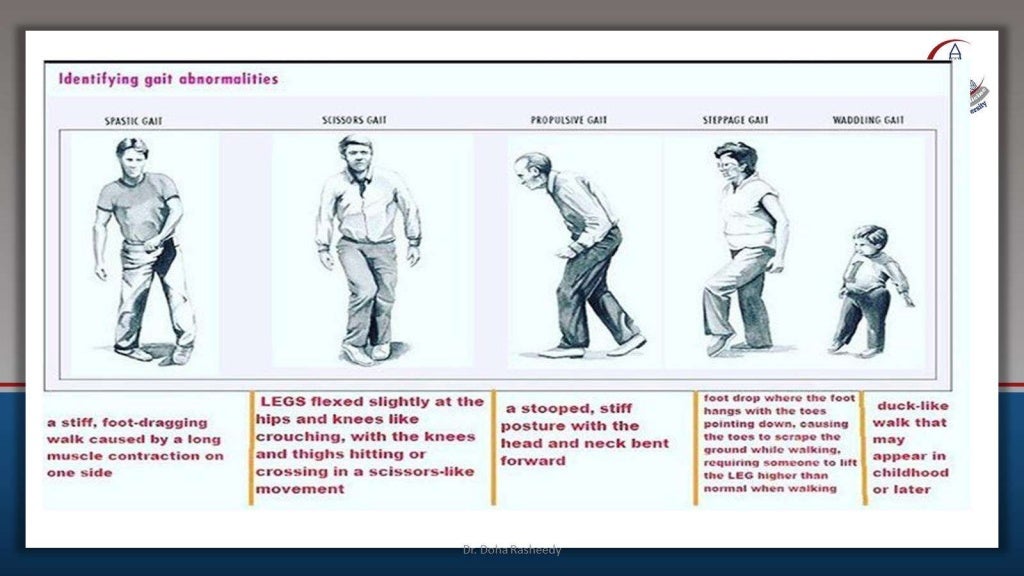 Gait in elderly | PPTX