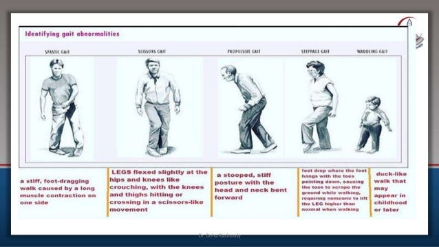Gait in elderly | PPTX