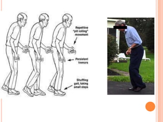 Gait abnormalities | PPSX