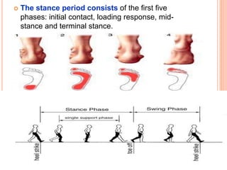 Gait abnormalities | PPSX