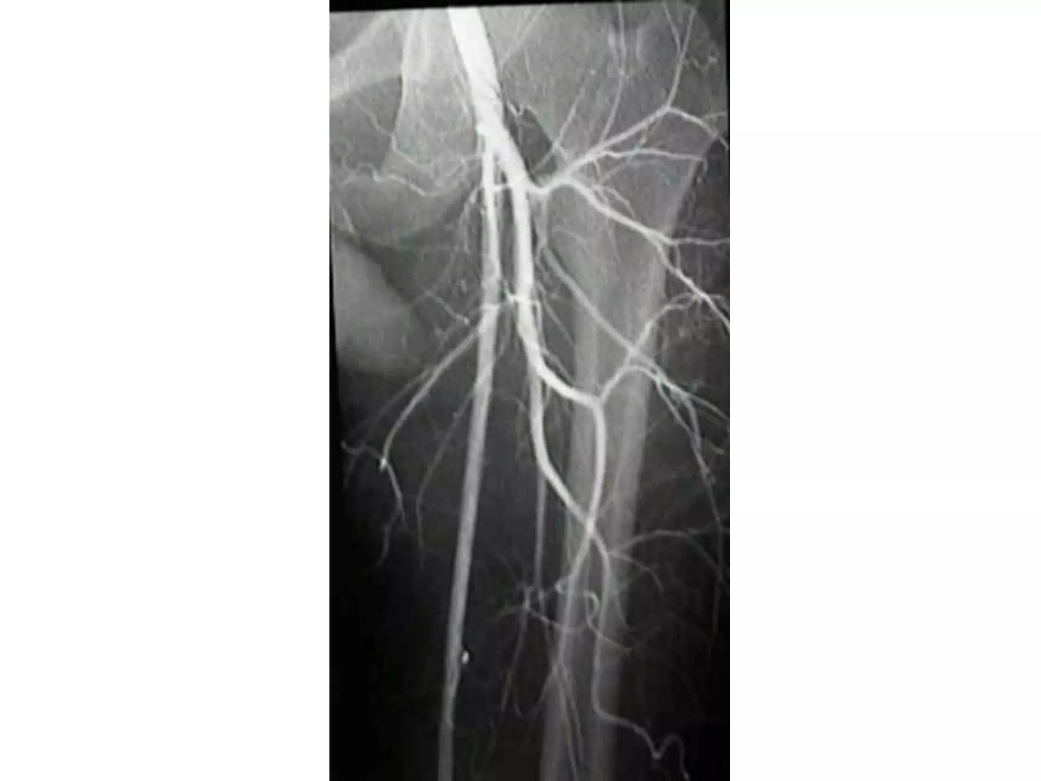 Review of Gait, Locomotion & Lower Limbs | PPT