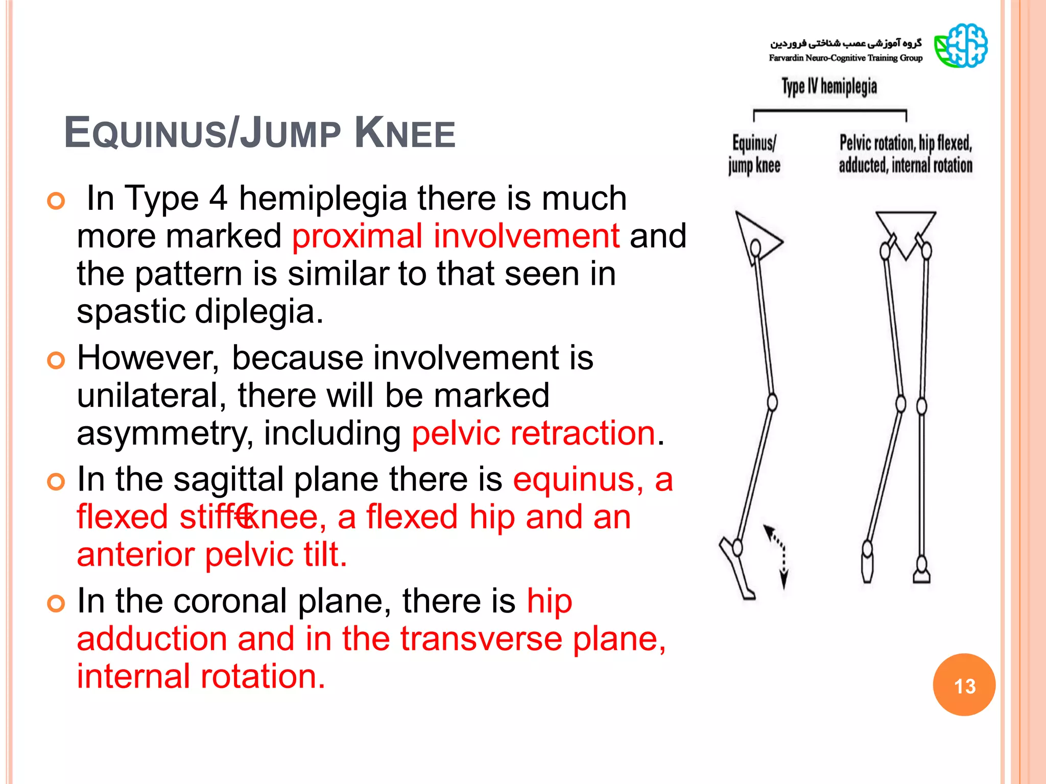 Gait pattern classification in children with cp | PDF