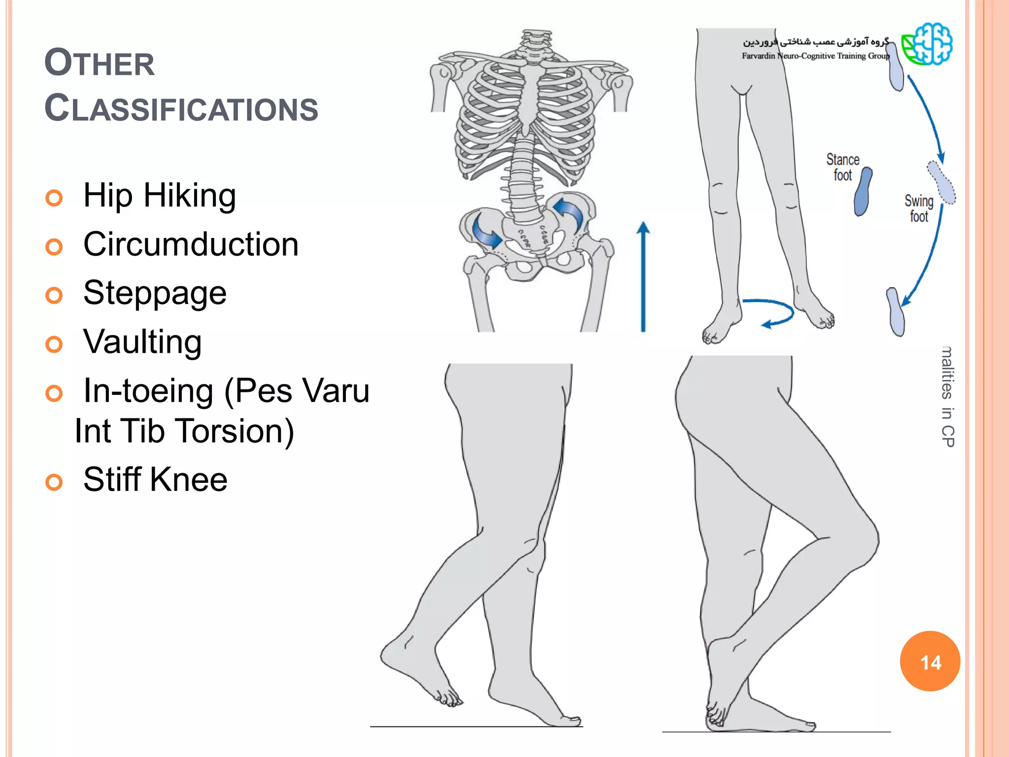 Gait pattern classification in children with cp | PDF