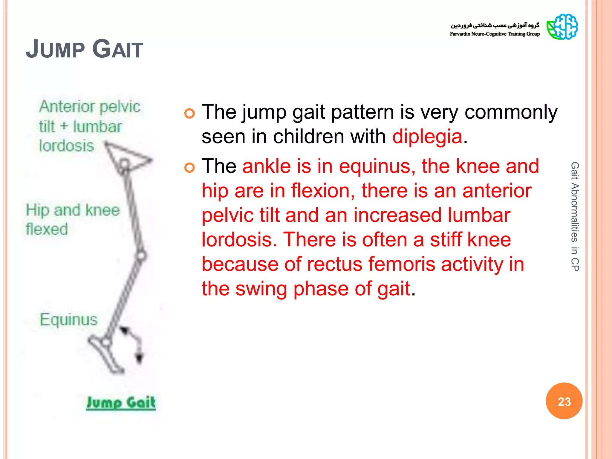 Gait pattern classification in children with cp | PDF