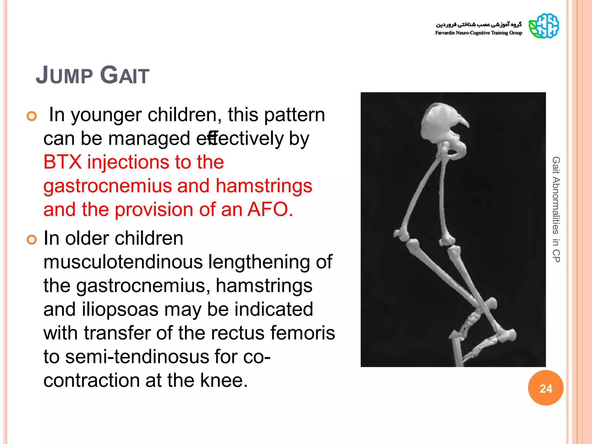 Gait pattern classification in children with cp | PDF
