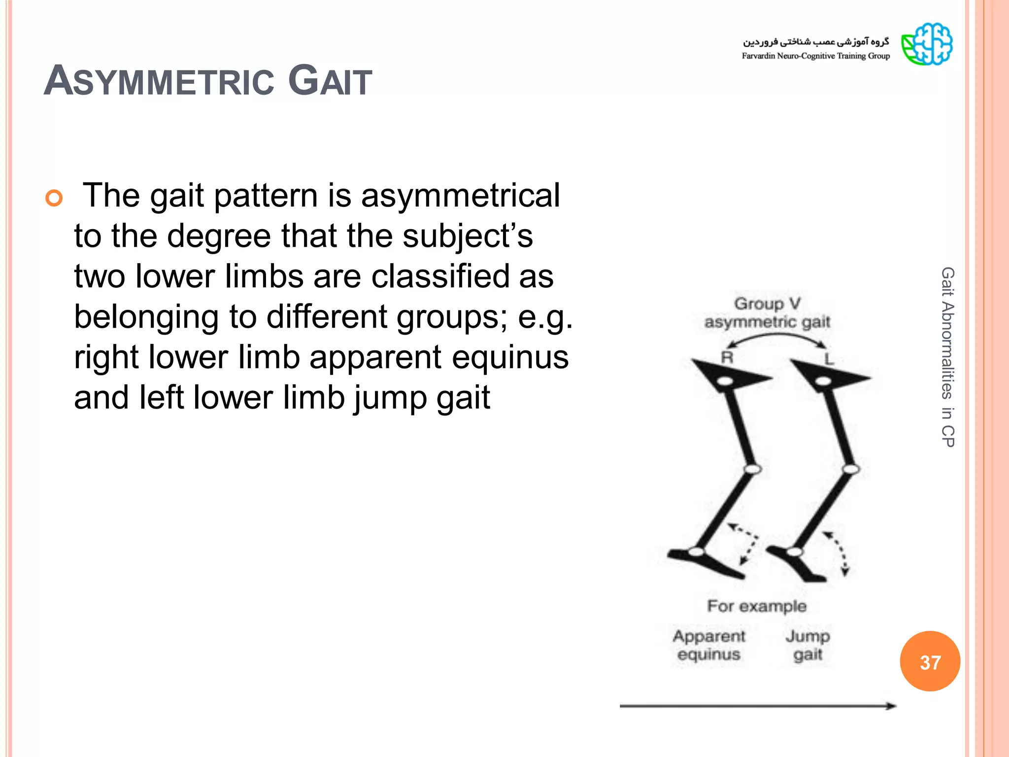 Gait pattern classification in children with cp | PDF