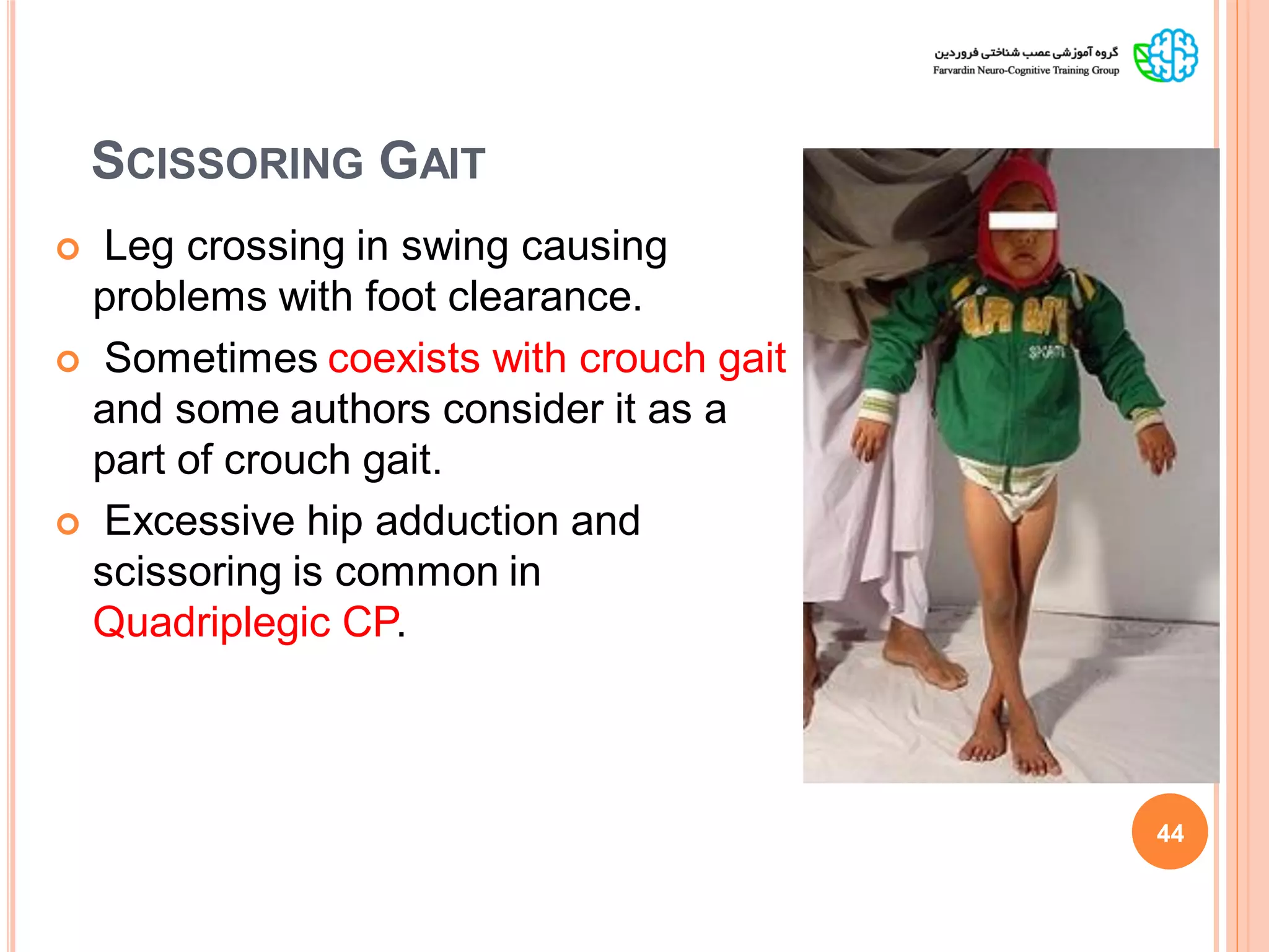 Gait pattern classification in children with cp | PDF