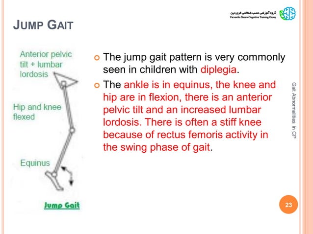 Gait pattern classification in children with cp | PDF