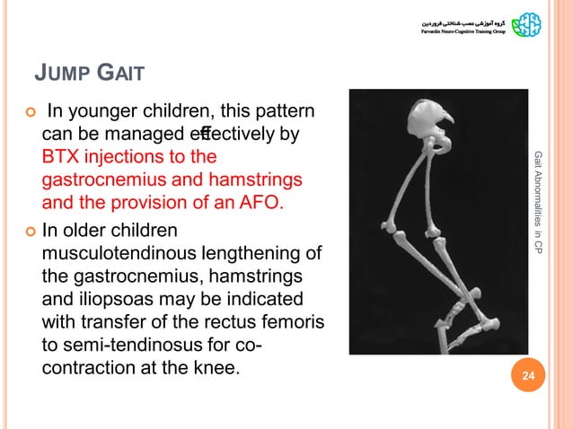 Gait pattern classification in children with cp | PDF