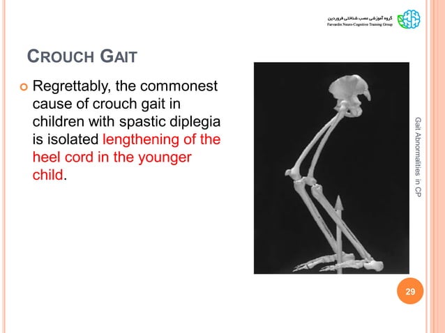 Gait pattern classification in children with cp | PDF