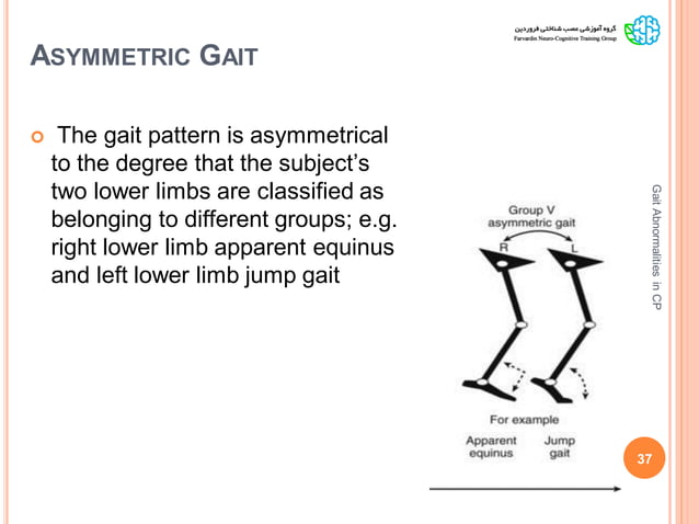 Gait pattern classification in children with cp | PDF