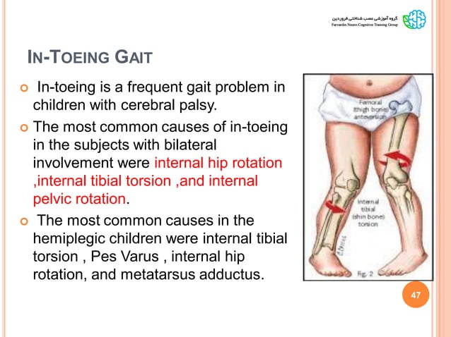 Gait pattern classification in children with cp | PDF