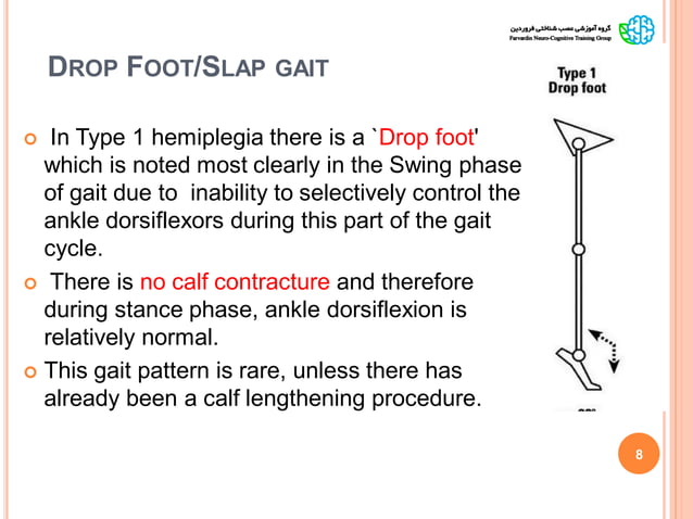Gait pattern classification in children with cp | PDF
