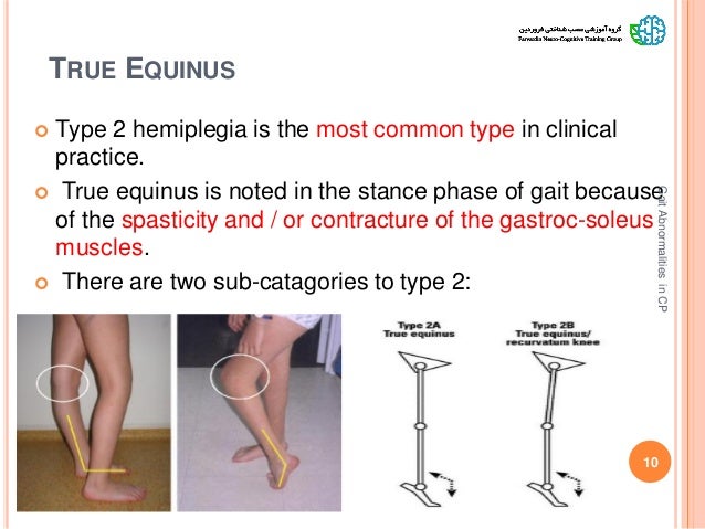 Gait pattern classification in children with cp