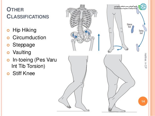 Gait pattern classification in children with cp