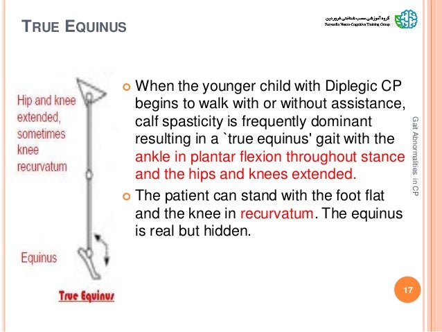 Gait pattern classification in children with cp