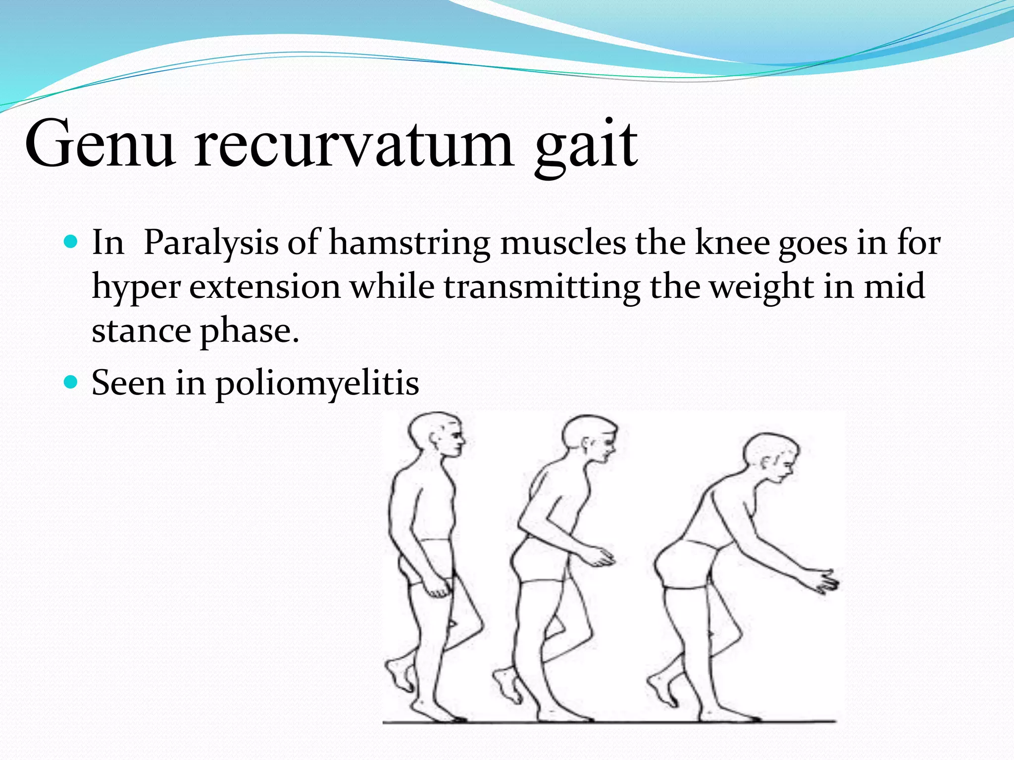 Gait | PPTX
