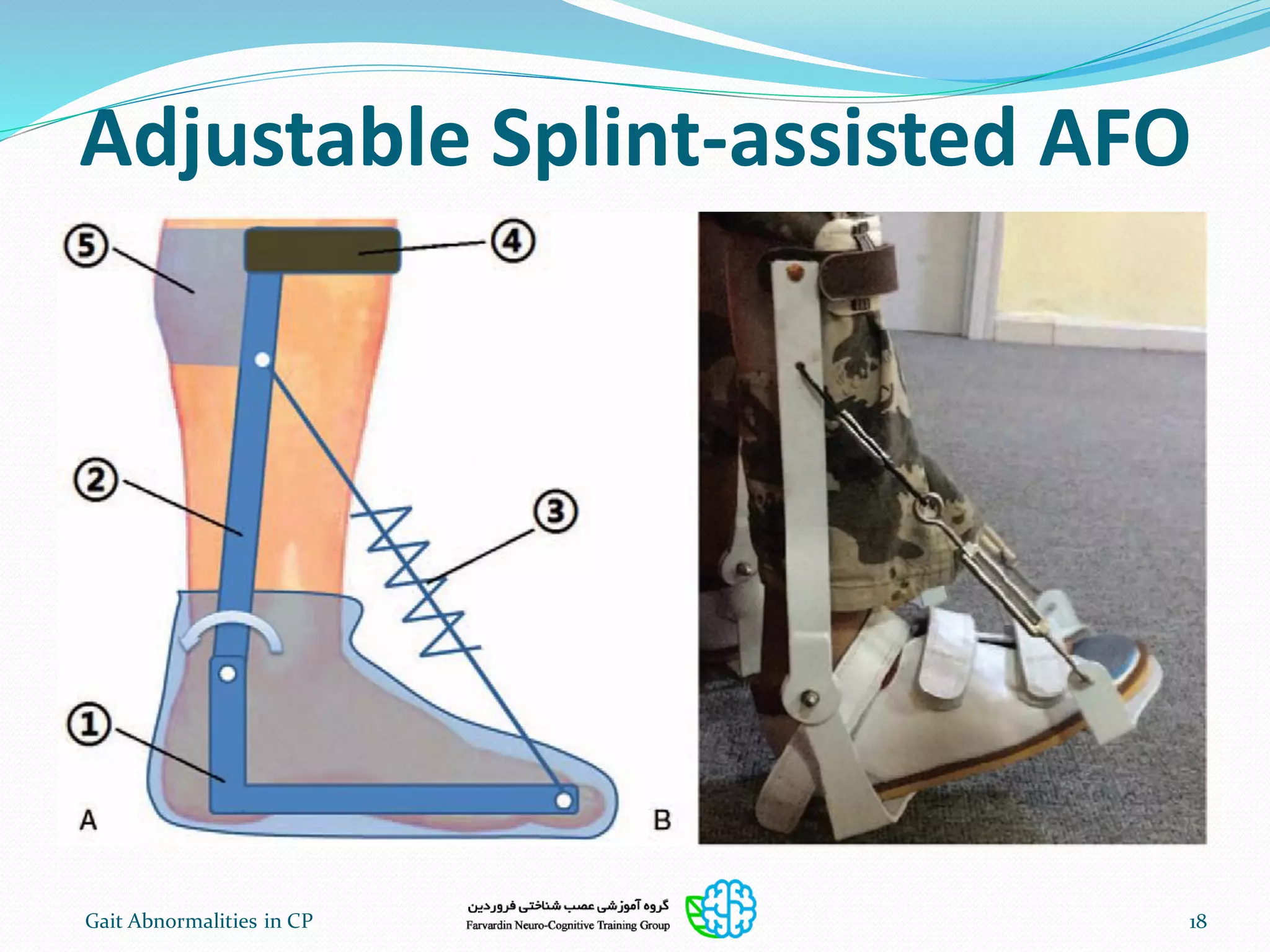 Gait training in children with cp | PDF