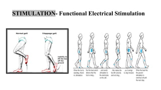 Gait training in physiotherapy.pptx