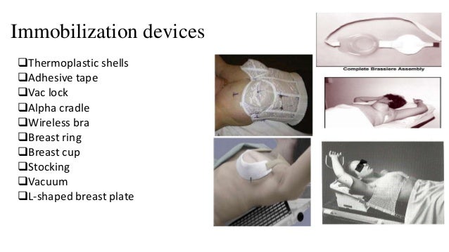radiation therapy in ca breast