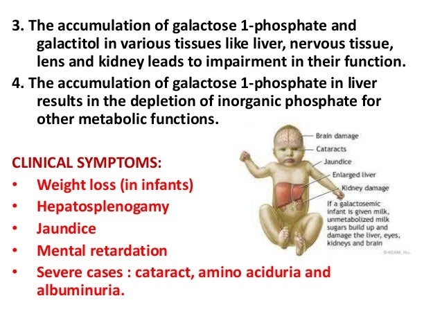 Galactose metabolism disorders