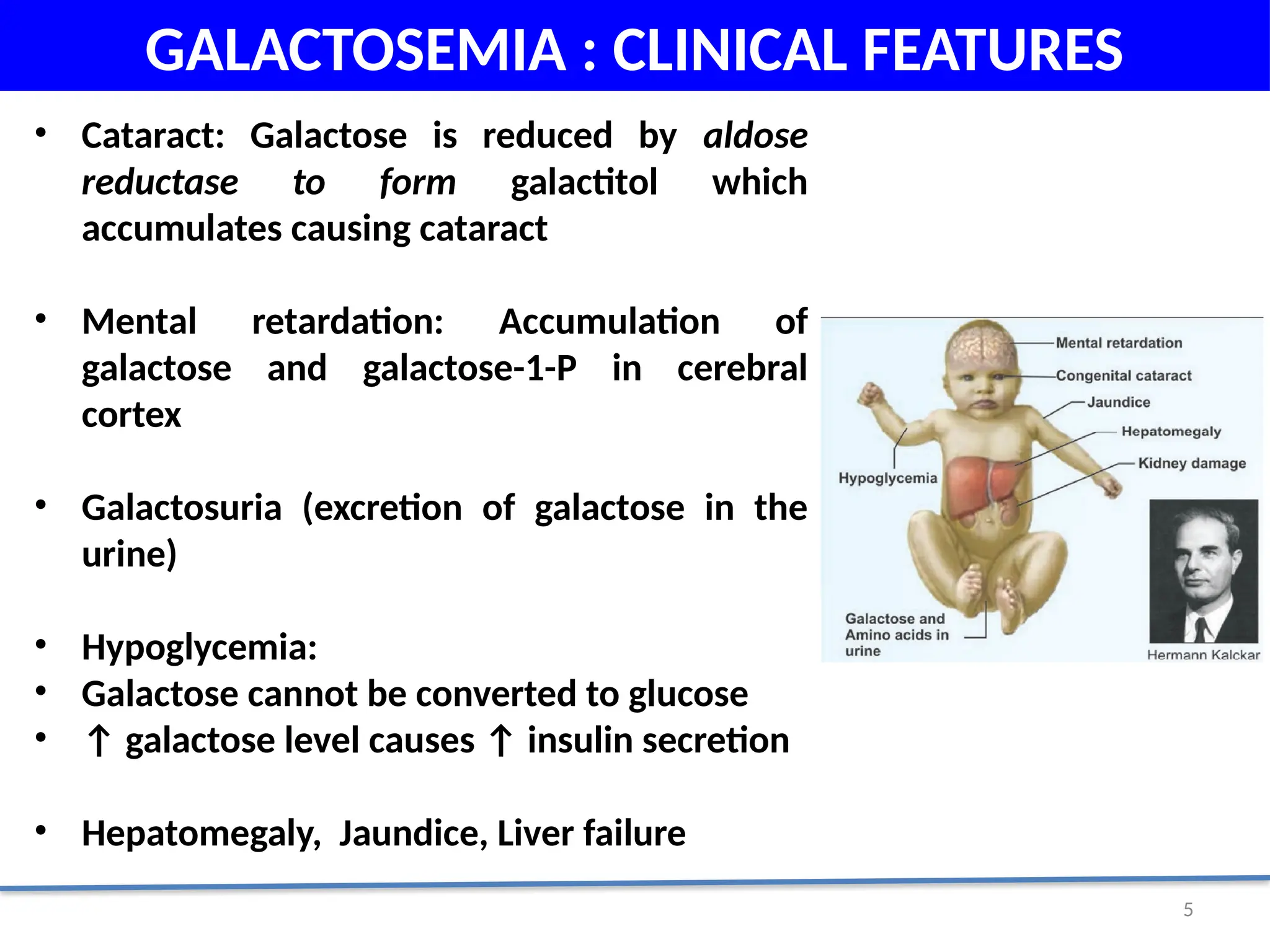Galactose metabolism and it's disorder (galactosemia) | PPTX