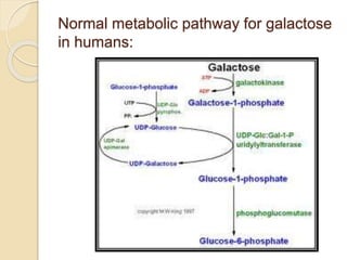 Galactosemia Pathway