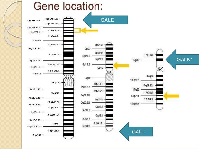 Galactosemia Chromosome Brain Function In Classic Galactosemia, A