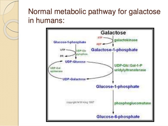 Galactosemia Pathway
