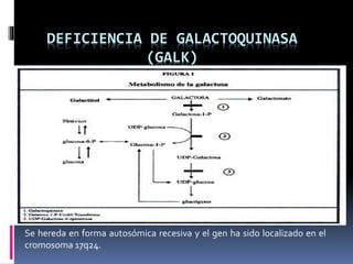 Galactosemia congénita | PPTX