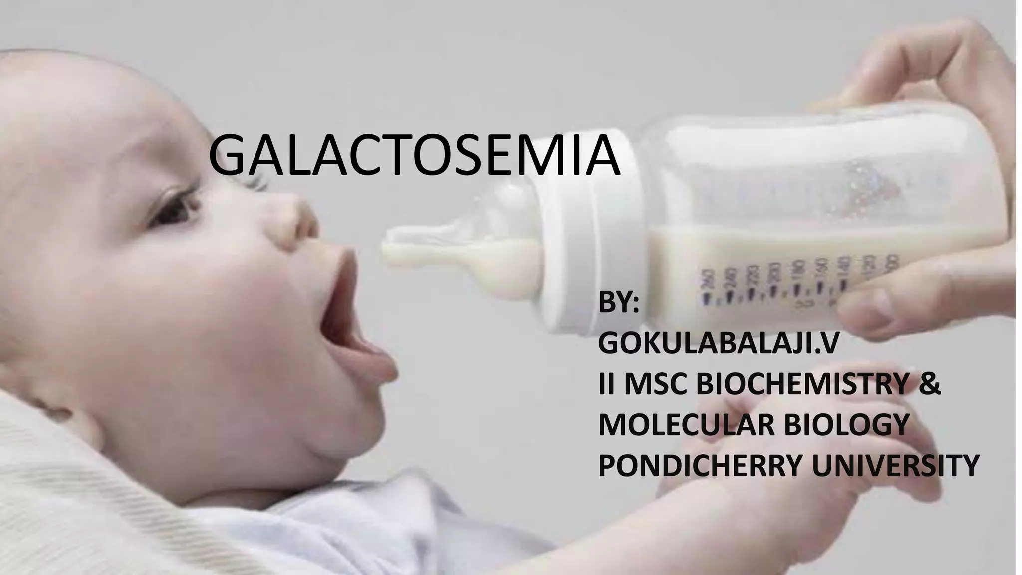 Galactosemia ppt | PPTX