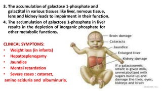 Galactosemia ppt | PPTX