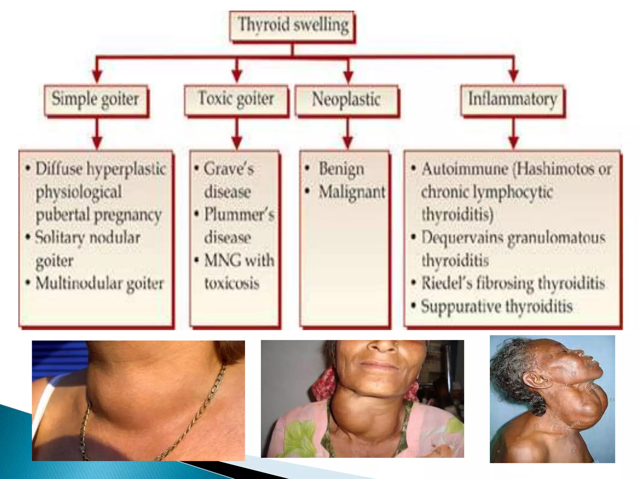 Galaganda (Goitre) | PPSX | Thyroid Disorders | Endocrine and Metabolic ...