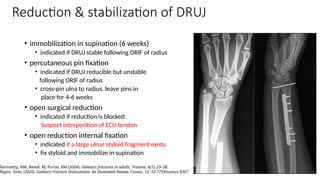 GALEAZZI_fractureeeeeeeeeeeeeeeeeeee pptx | PPT