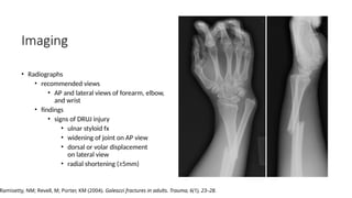 GALEAZZI_fractureeeeeeeeeeeeeeeeeeee pptx | PPTX