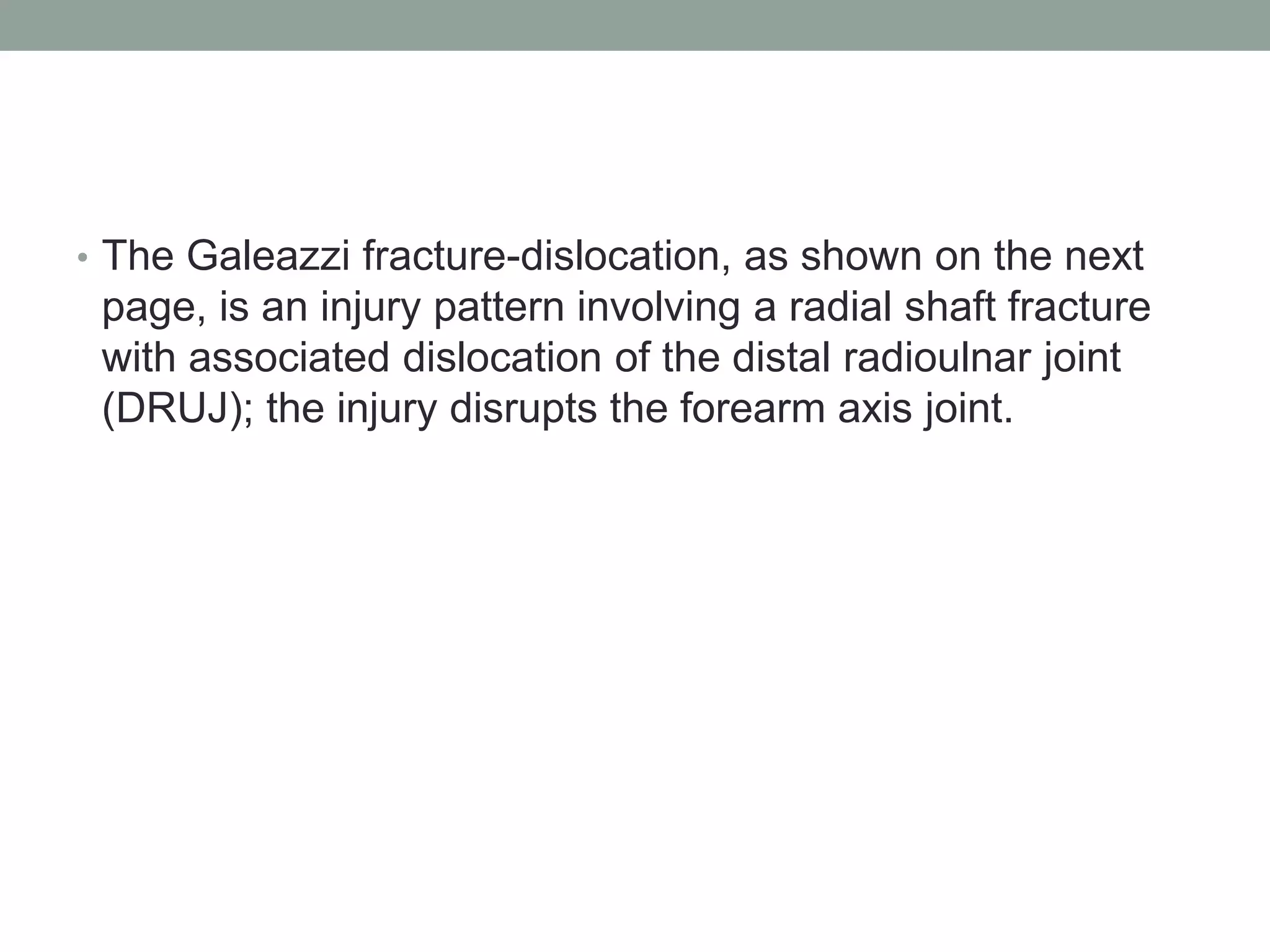 Galeazzi Fracture | PPTX