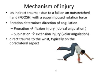 Galeazzi fracture dislocation | PPTX