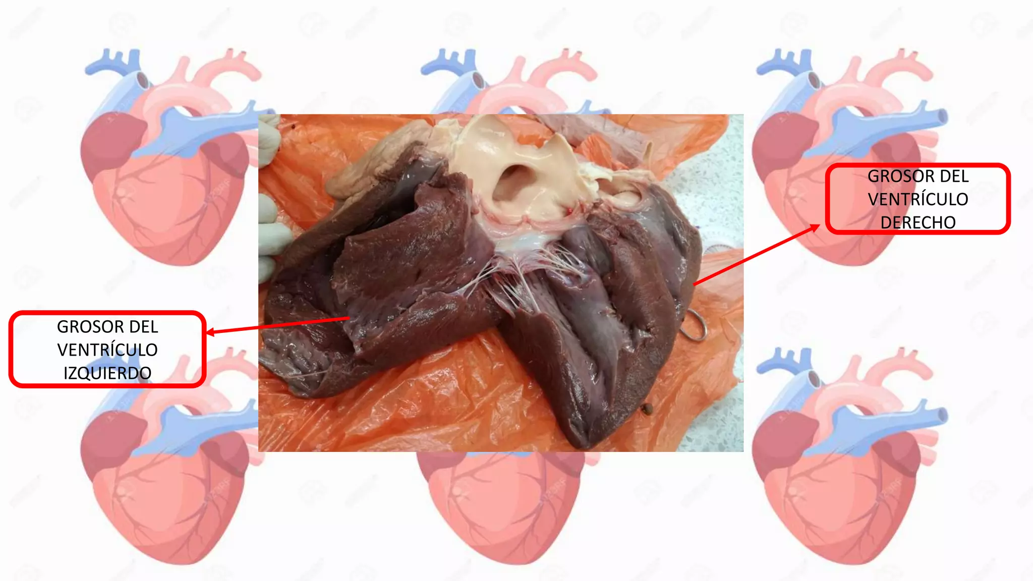 DISECCIÓN DEL CORAZÓN | PPTX