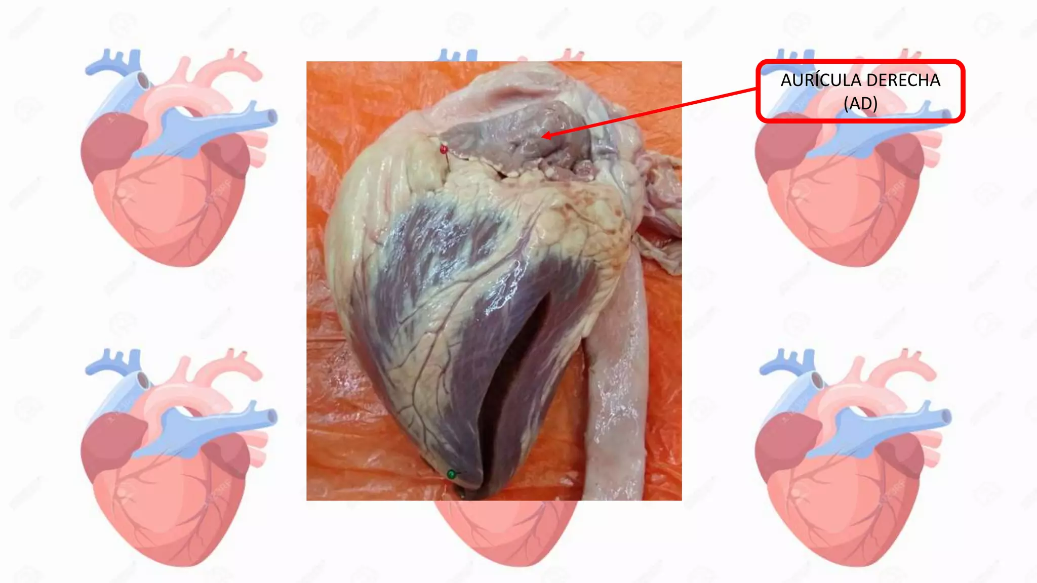 DISECCIÓN DEL CORAZÓN | PPTX