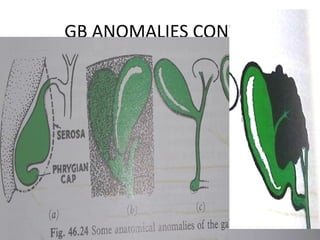 Gallbladder | PPT
