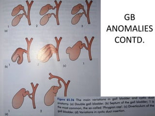 Gallbladder | PPT